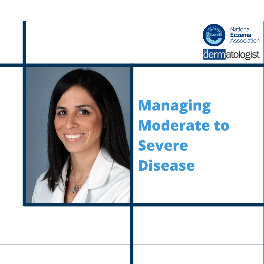 Managing Moderate to Severe Disease