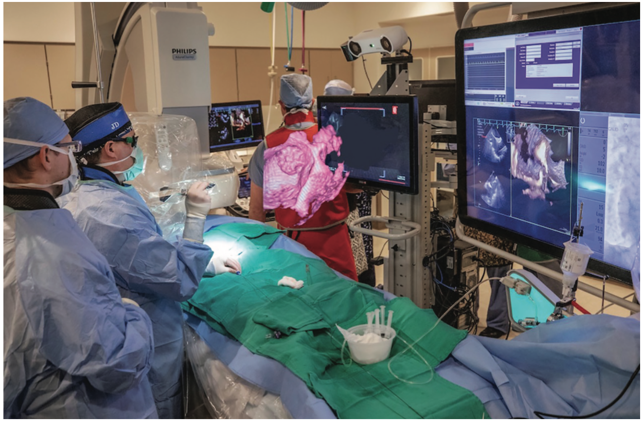 EchoPixel’s 4-D Holographic Intraoperative Imaging for Cardiac Anatomy ...