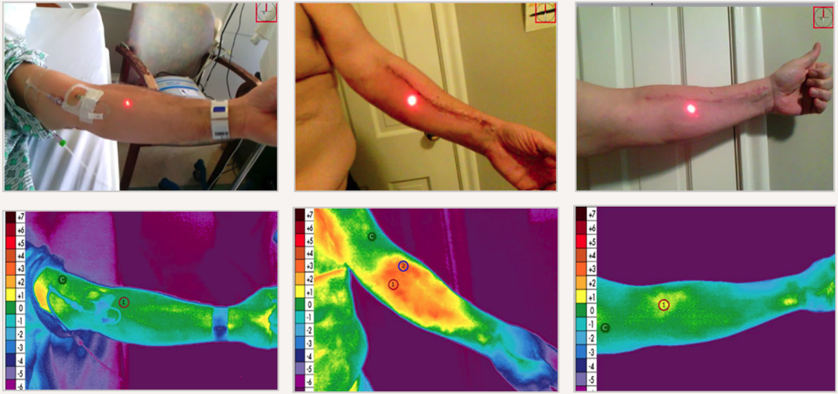 Use of Multimodal Long-Wave Infrared Thermography Devices in Clinical ...