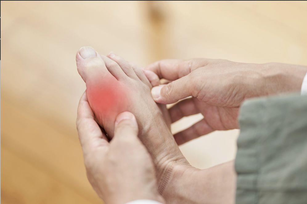 Poster Highlight: A Patient With a 40-Year History of Tophaceous Gout ...
