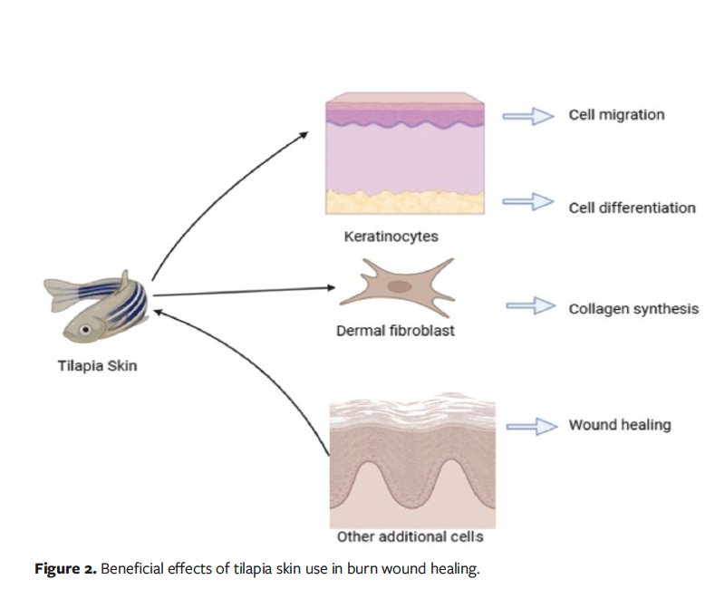 Advances in Burn Wound Management: Innovative Strategies for Healing ...