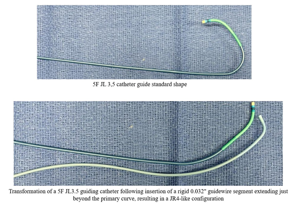 FAST-CATH: A Modified Single Catheter Technique for Complete Coronary ...