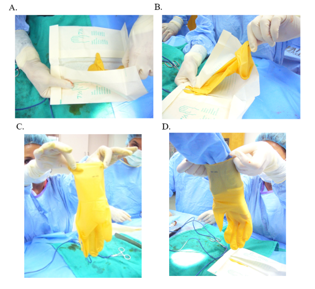 Is Iatrogenic Implant Contamination Preventable Using a 16-Step No ...