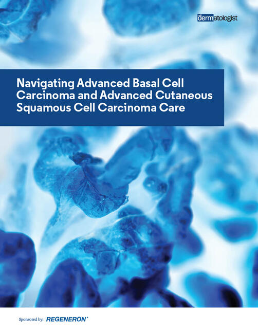 Navigating Advanced Basal Cell Carcinoma and Advanced Cutaneous ...