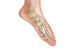 PROstep Minimally Invasive Surgery